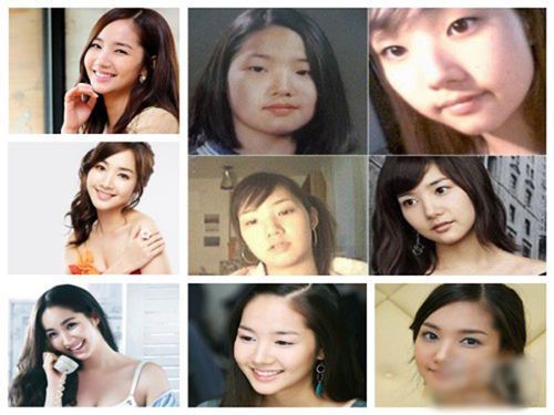 盘点陷整容风波的明星情侣们 |刘恺威|李敏镐|整容_新浪女性_新浪网